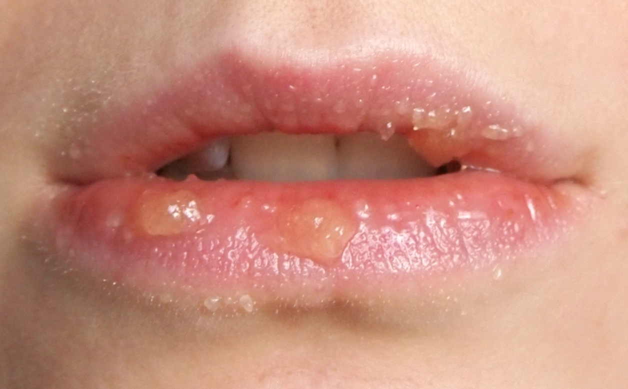 Bewitchery Homemade Sugar Lip Scrub Bewitchery Homemade Sugar Lip Scrub